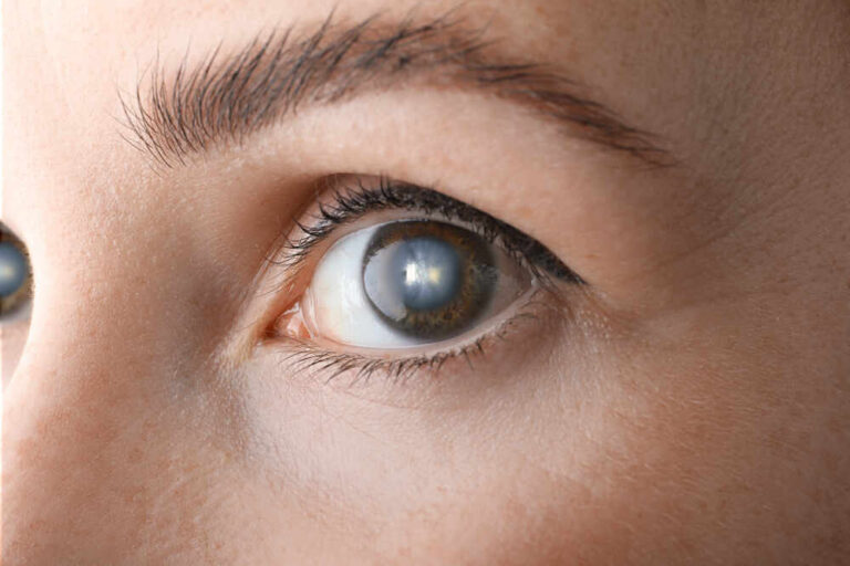 Cyclops Ancestor: Human Eyes’ Shocking Origin | American Seeker
